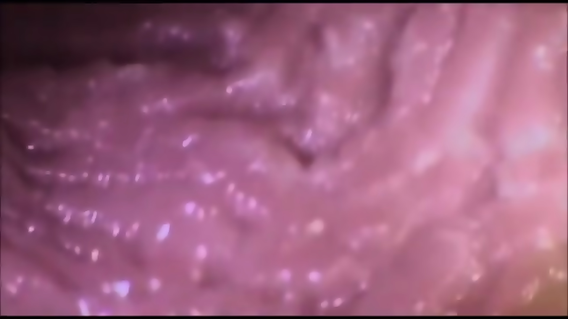 Cock Cums In Pussy Internal View Eporner