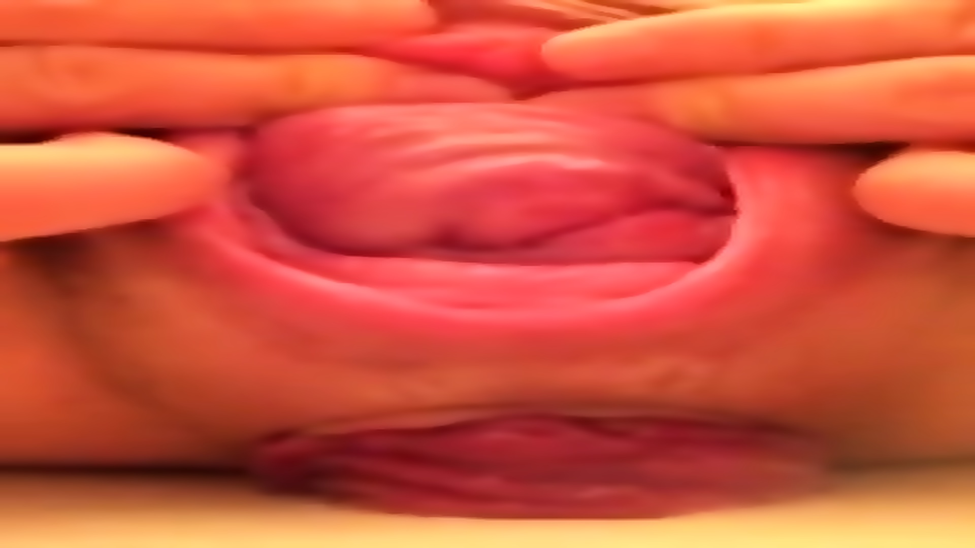 Prolapsing Both Holes Eporner