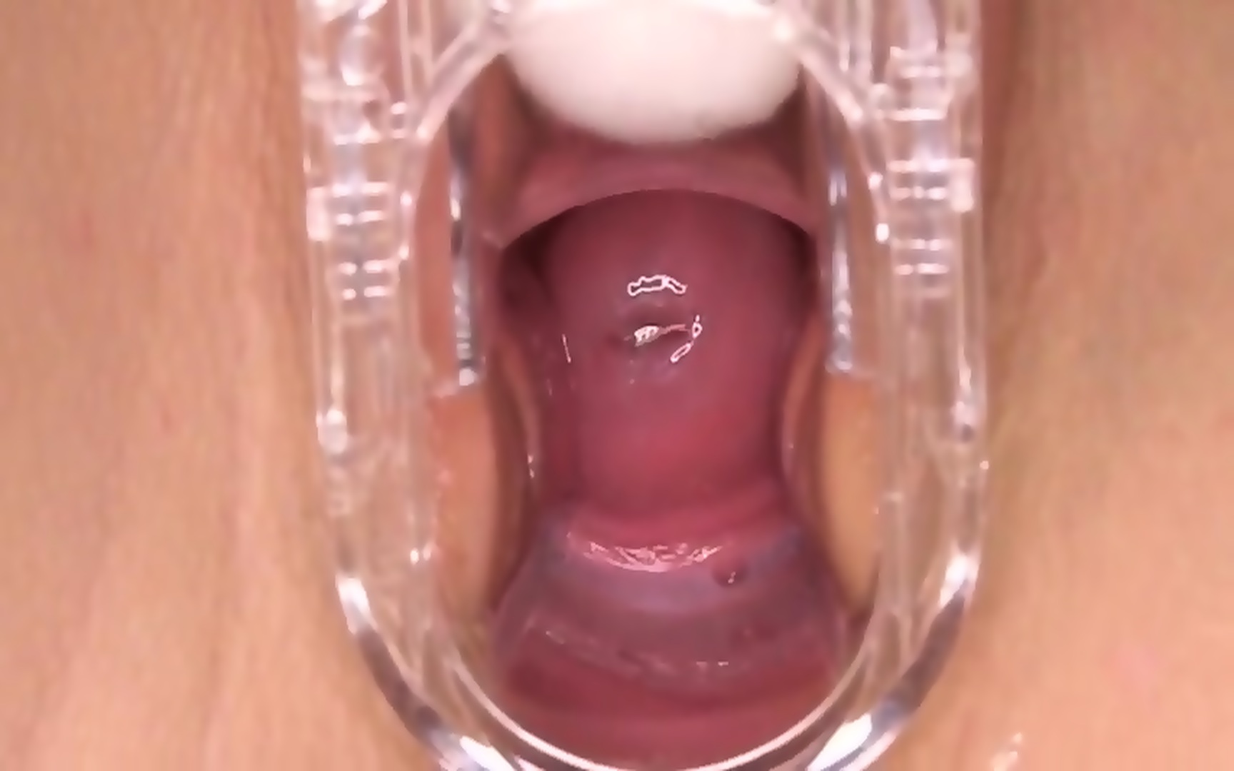 Cervix Brown Eporner