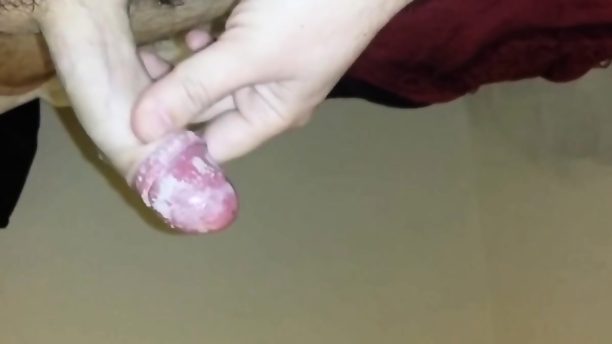 Smegmacheese Cock Eporner