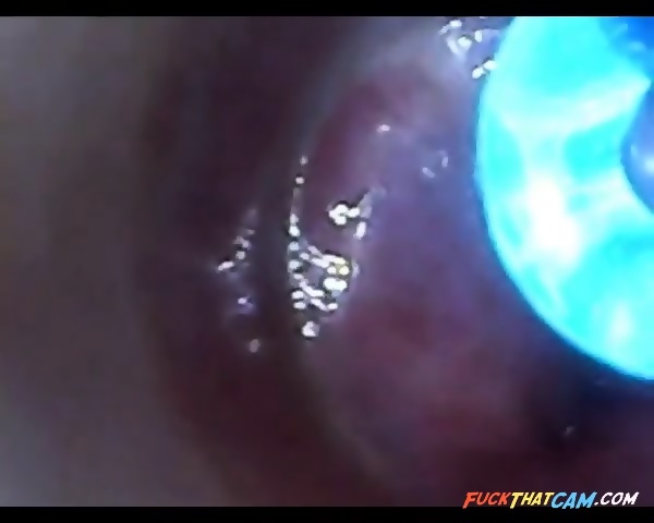 Test Tube Cock Endoscope Pov Urethral Insertion Ball Rod Eporner
